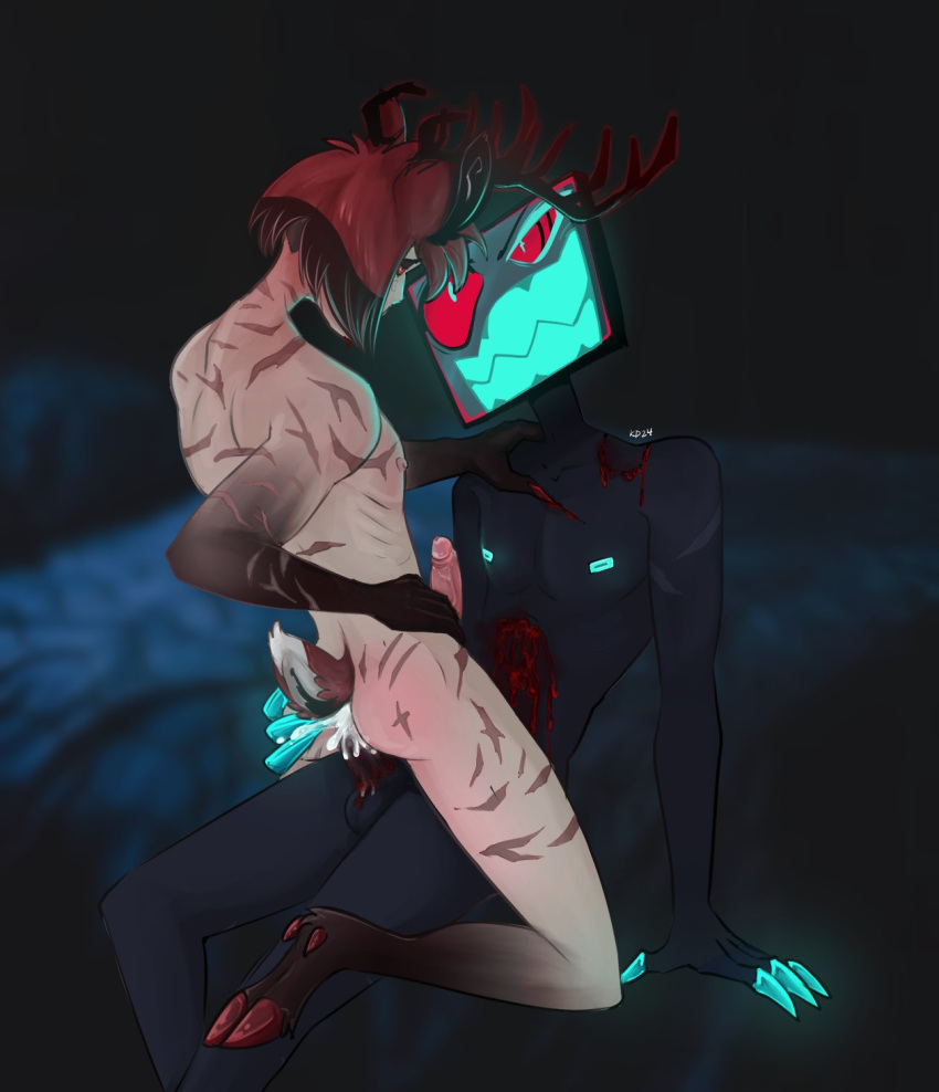 Rule 34 2boys Alastor Hazbin Hotel Anal Antlers Bite Bite Marks 0637
